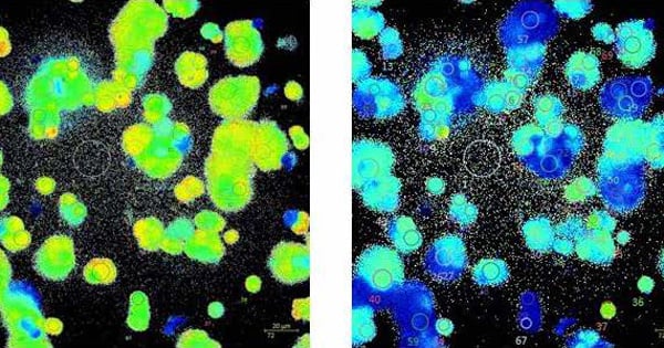Calcium Imaging at Heidelberg University | Teledyne Vision Solutions