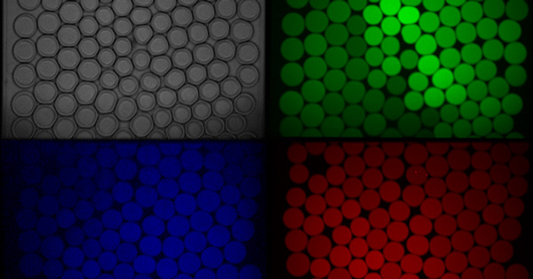 Dynamic Microfluidic Imaging | Teledyne Vision Solutions