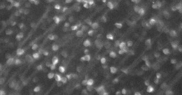 Functional Calcium Retinal Imaging | Teledyne Vision Solutions