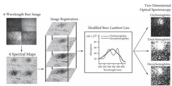 Intrinsic Signal Optical Imaging | Teledyne Vision Solutions