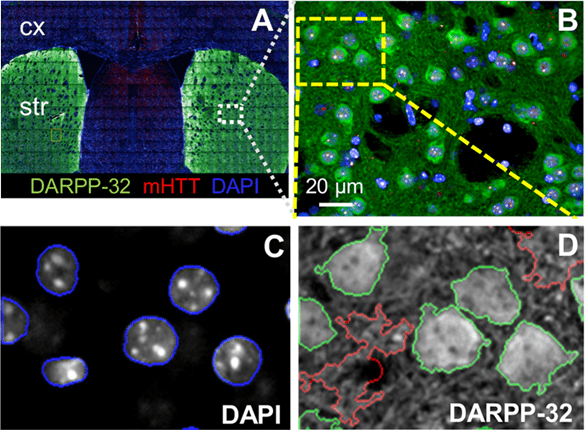 Introduction To High Content Imaging | Teledyne Vision Solutions
