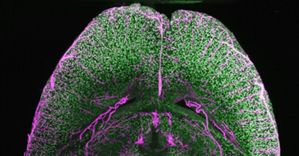 mesoSPIM | Teledyne Vision Solutions