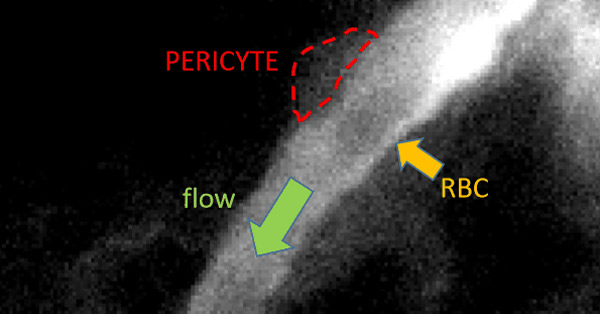 Neural Vascular Imaging | Teledyne Vision Solutions