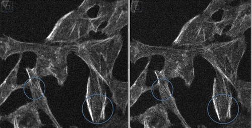 Prime 95B sCMOS for Spinning Disk Confocal Microscopy | Teledyne Vision ...