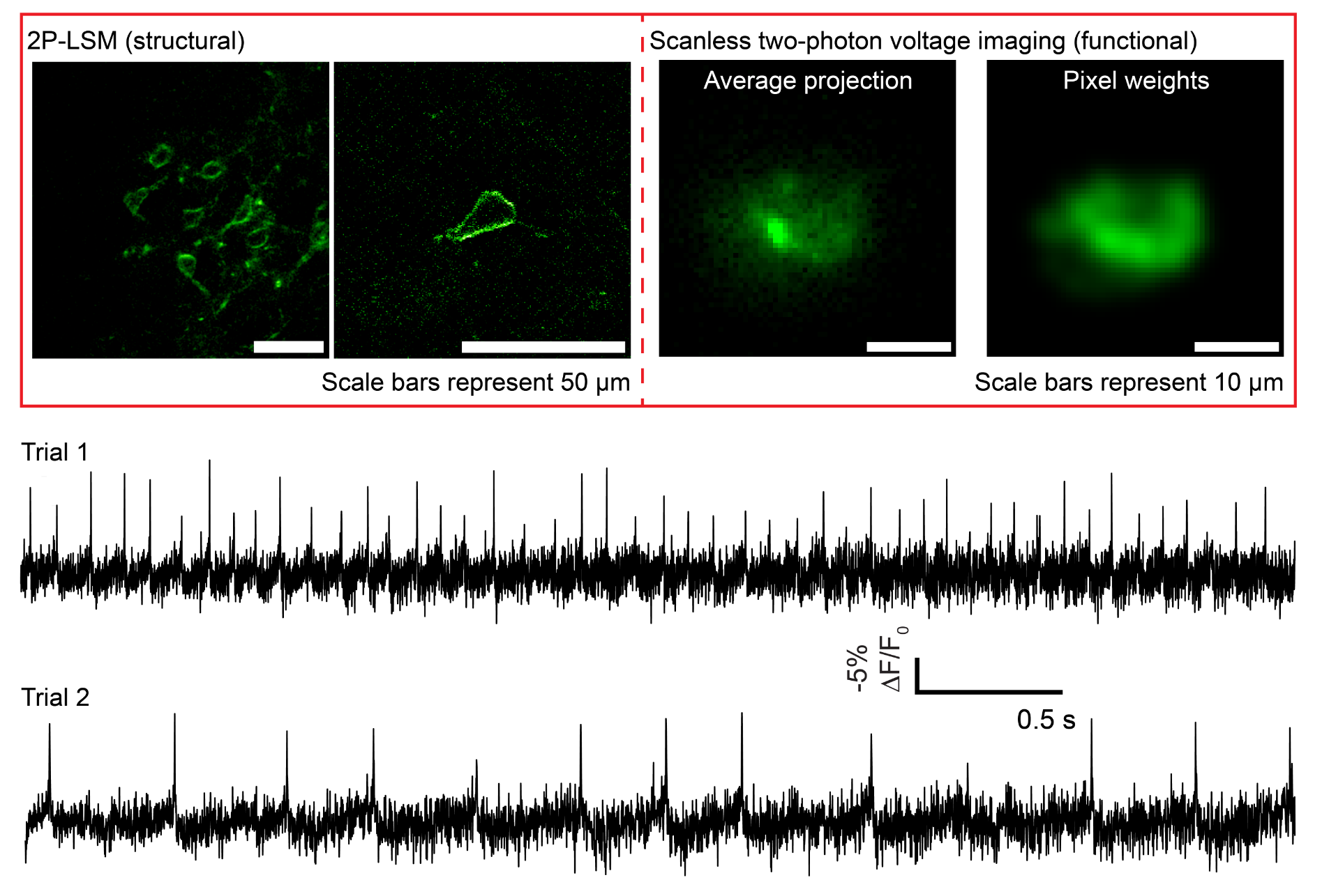 Scanless Two-Photon Voltage Imaging | Teledyne Vision Solutions
