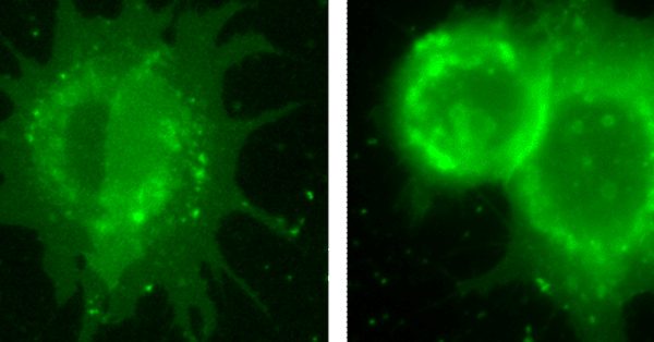 Super-Resolution Standing Wave Microscopy | Teledyne Vision Solutions