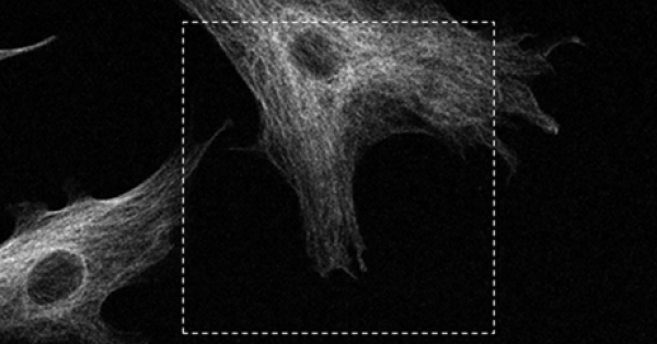 The Evolution Of Spinning Disk Confocal Microscopy | Teledyne Vision ...